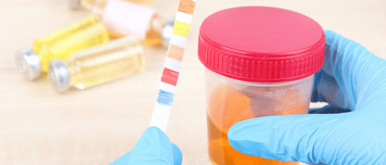 Inconclusive Drug Test Results (5 Common Causes Explained)
